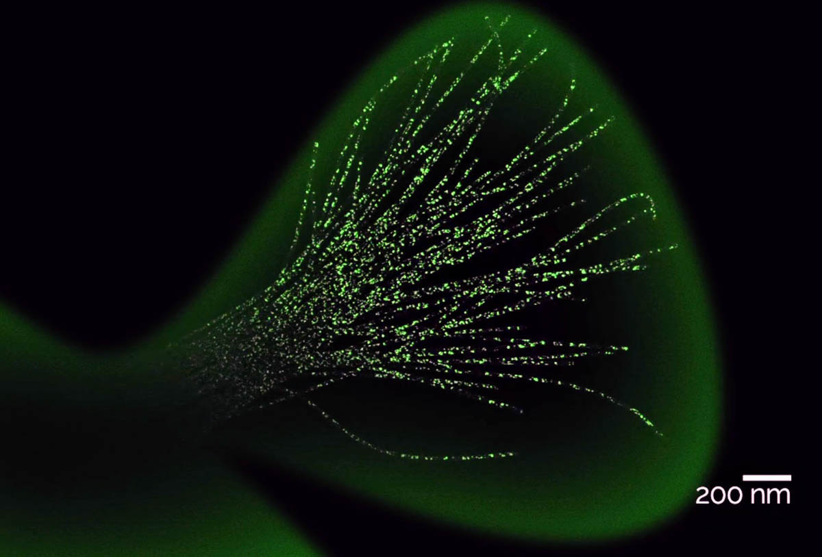 Biophotonics - biophotonique.ulaval.ca